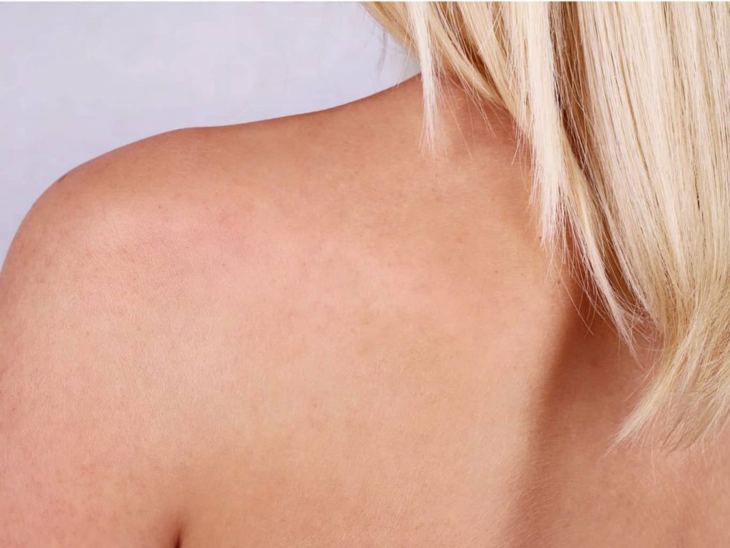 A skin tag is a small flap of tissue that hangs off the skin by a ...
